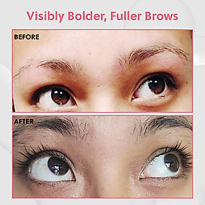 ForChics ForBrow Eyebrow Growth Serum For Thicker Brows - Natural & Organic Conditioner For Fuller and Thick Eyebrows | Vegan & Cruelty-Free Formula | New Innovative Peptides - [0.10 fl. oz/ 3ml]