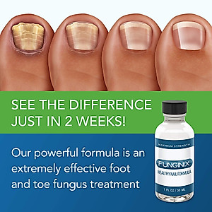 FUNGINIX Fungus Treatment - Toenail, Finger Fungus, and Foot Fungus Solution - Antifungal Spray - Made In the USA - Extra Strength (1 Bottle)