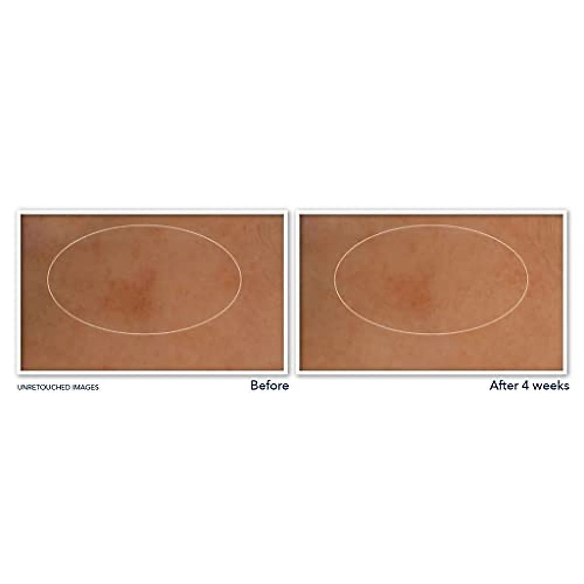 RoC Multi Correxion Revive + Glow 20% Pure Vitamin C Night Serum Capsules for Brightening, Dark Spots, and Texture