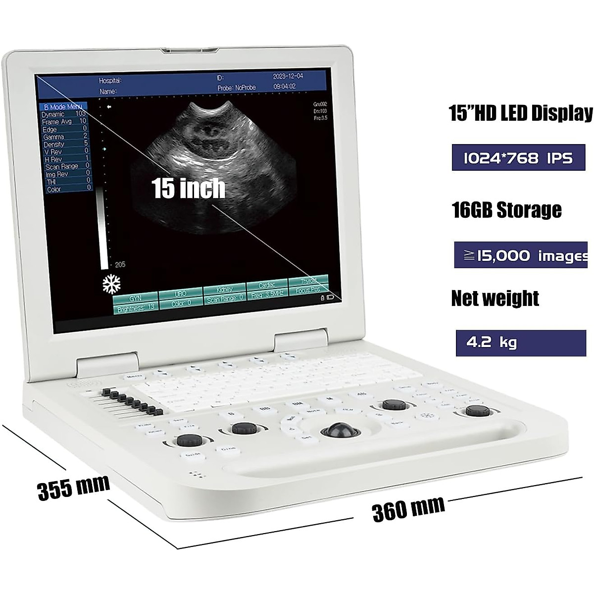 JZRYL Portable Vet/Veterinary B-Ultrasound Scanner with 3.5Mhz Convex Probe for Horse,Goat,Cow,Sheep and Pig use (3.5 MHz Convex Probe)