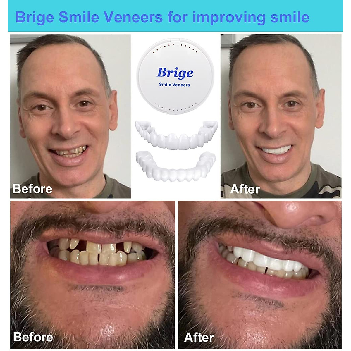 Brige Smile Teeth Denture Temporary False Teeth Improve Smile