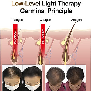 LESCOLTON Hair Growth System, FDA Cleared, 80 Laser Diodes Rechargeable Red Light Therapy Cap & Helmet Hair Regrowth and Hair Loss Treatment Device For Thinning Hair (2nd Generation)