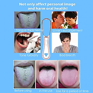 Xiahium Tongue Scraper, Fresh Breath Tongue Cleaner Reusable Fight Bad Breath Healthy Oral Care for Adults Kids - 100% BPA Free