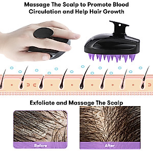 Scalp Massager, Shampoo Brush Hair Scrub Brush for Wet and Dry Hair, Soft Silicone Bristles Head Massager Clean Hair, Reduce Dandruff, Massage Scalp, Promote Hair Growth