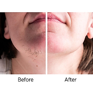 VOGCREST Hair Trimmer, 2 in 1 Facial Hair Remover & Eyebrow Trimmer for Women - Rechargeable, Portable, LED Light