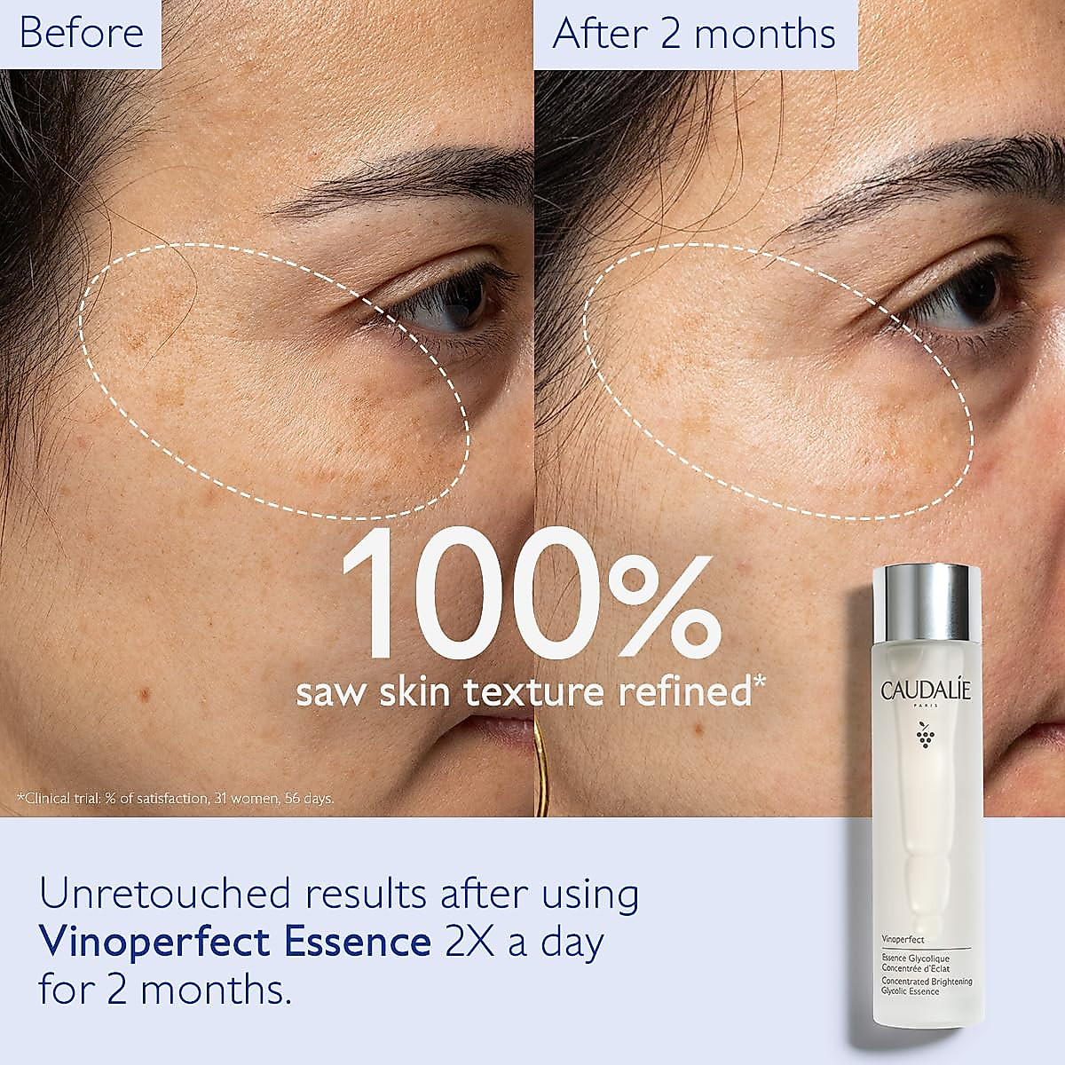 Caudalie Vinoperfect Dark Spot Glycolic Essence with Niacinamide, 5 Fl. Oz