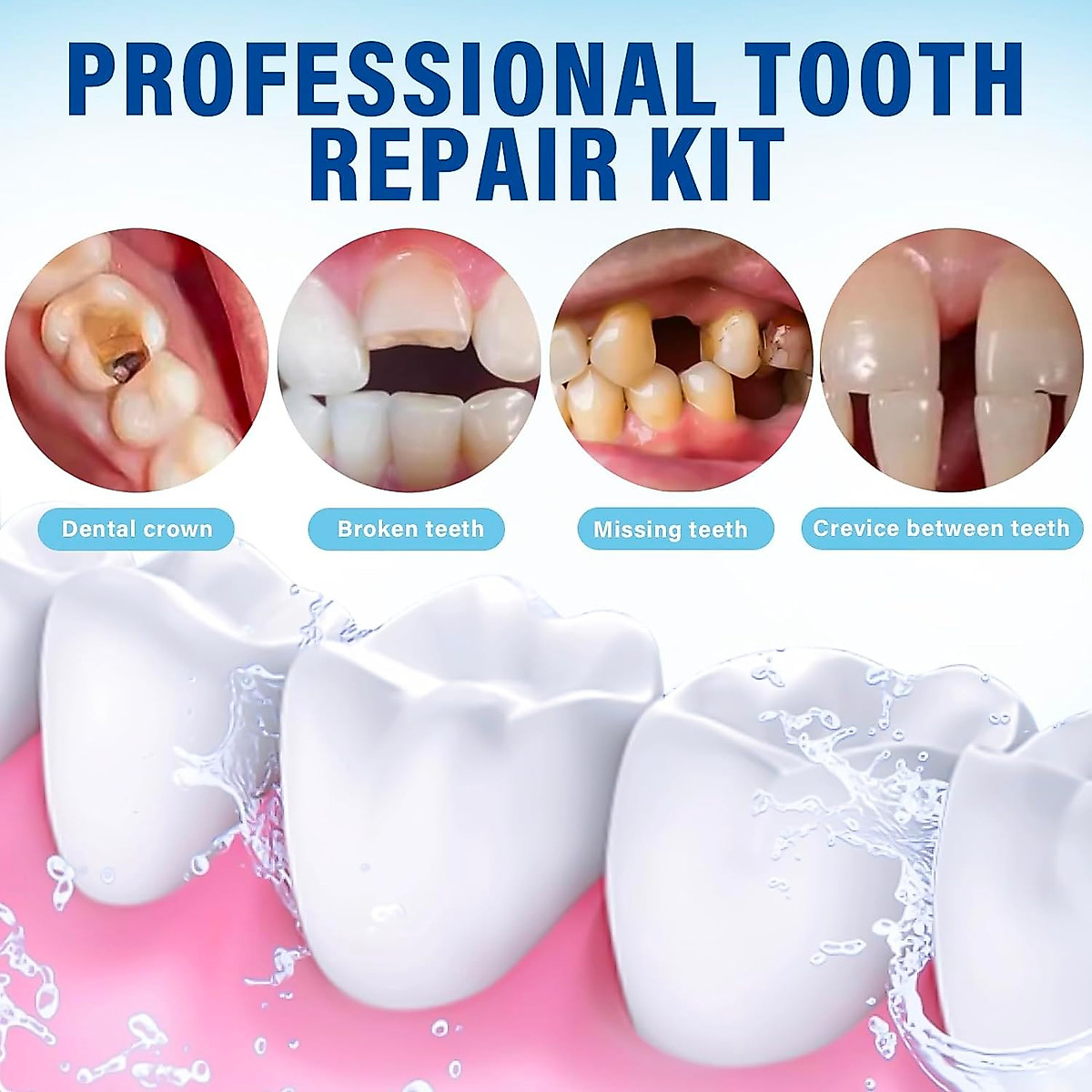 Tooth Replacement Kit, Replace a Missing Tooth in Minutes, Veneers for Temporary Tooth Repair, Complete Your Smile with Temporary Tooth, Nature and Comfortable Veneers