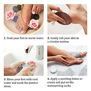 Pumice Stone for Feet & Moisturizing Heel Sleeves - Natural Lava Foot Stone Callus Removing Set - Cracked Heel Treatment - Foot Care Kit for Dry Cracked Feet Body Hands