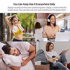 Tobcharm Back Acne Treatment, Butt Acne Clearing Treatment, Body Acne Treatment with Azelaic Acid 3.4 fl. oz., Great for Men and Women Acne Scar Treatment, Hormonal Acne And Cystic Acne Treatment