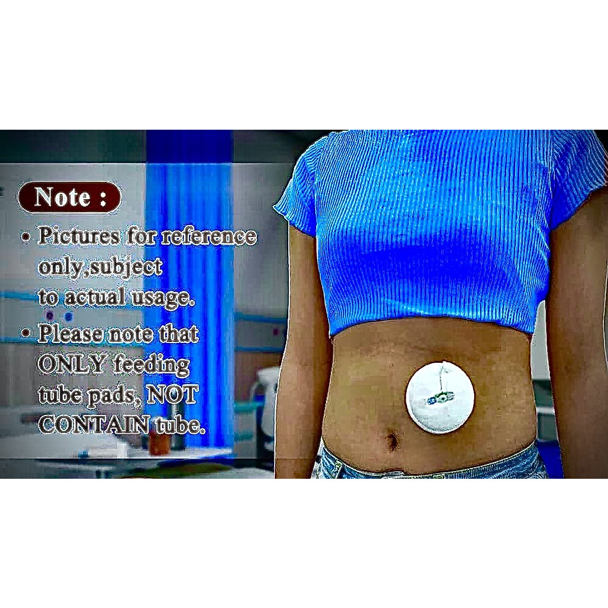 Cutie Button Pads G/j Tube Pad 10 Pack (Boy Mix)