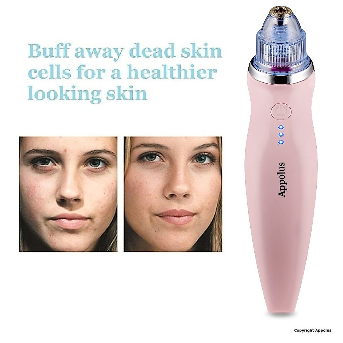 Microdermabrasion Machine - Appolus Premium Diamond Microdermabrasion Device for Flawless Glowing Skin - 2 Diamond Tips - 5 Heads - Anti-Aging - Pore Lines Wrinkles Sagging Minimizer