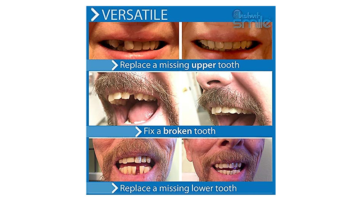 Instant Smile Temporary Tooth Kit Pro Series - Fake Teeth Solution