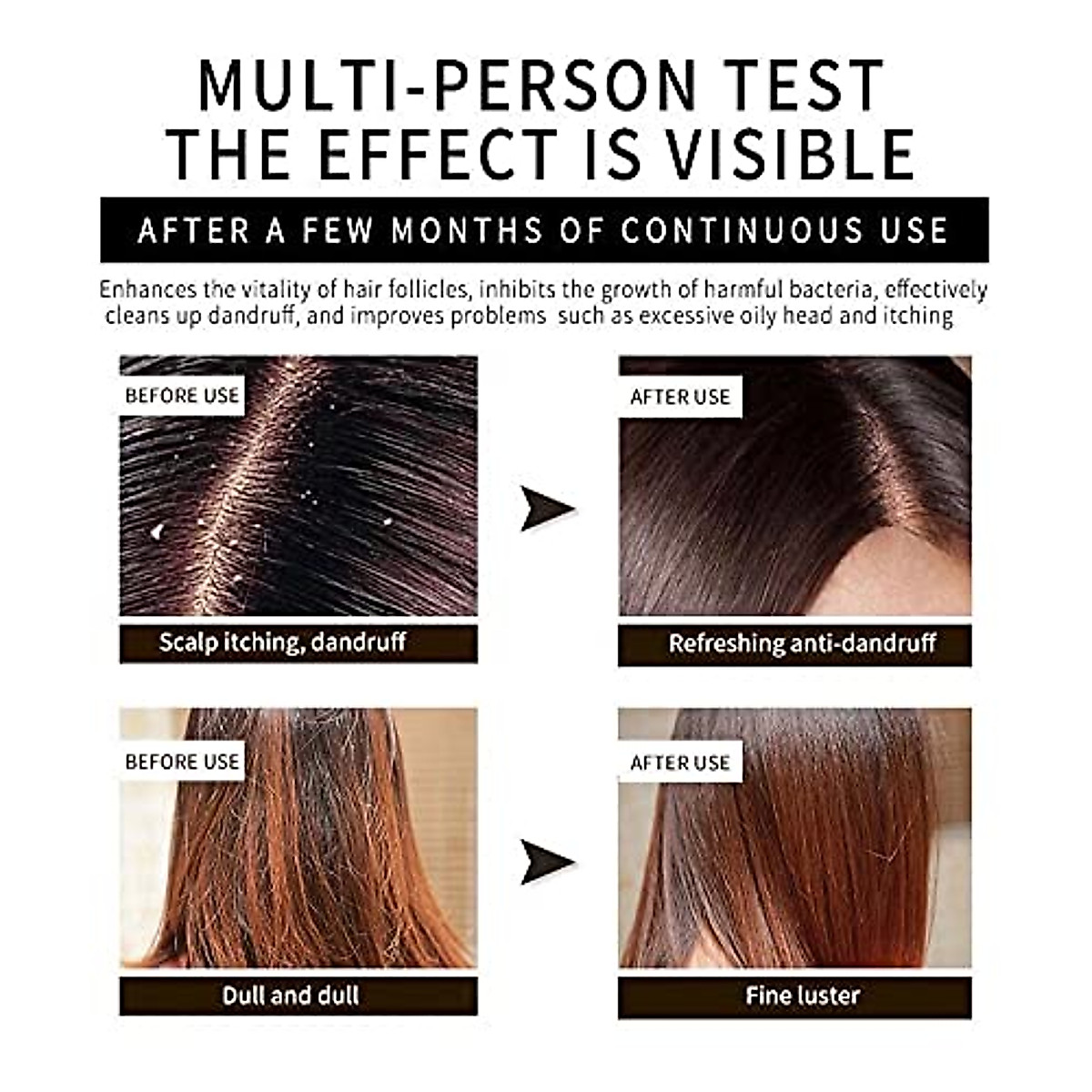 2 PC-ONIYEA Natural Handmade Shampoo Bar Soap, Oil Control, Deep Cleaning, Improve Acne On Scalp, 100% Organic Plant Extract Hair Wash, Women Men, Eco-friendly 1.92 Oz Each (TEATREE)