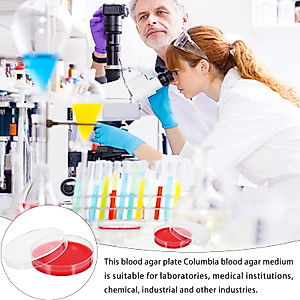 Baluue 10pcs Plastic Petri Dishes, Nutrient Agar Plate Sciences Nutrient Agar Petri Dishes Biological Dish Science Project Kit Supplies for Mushroom Petri Projects Red