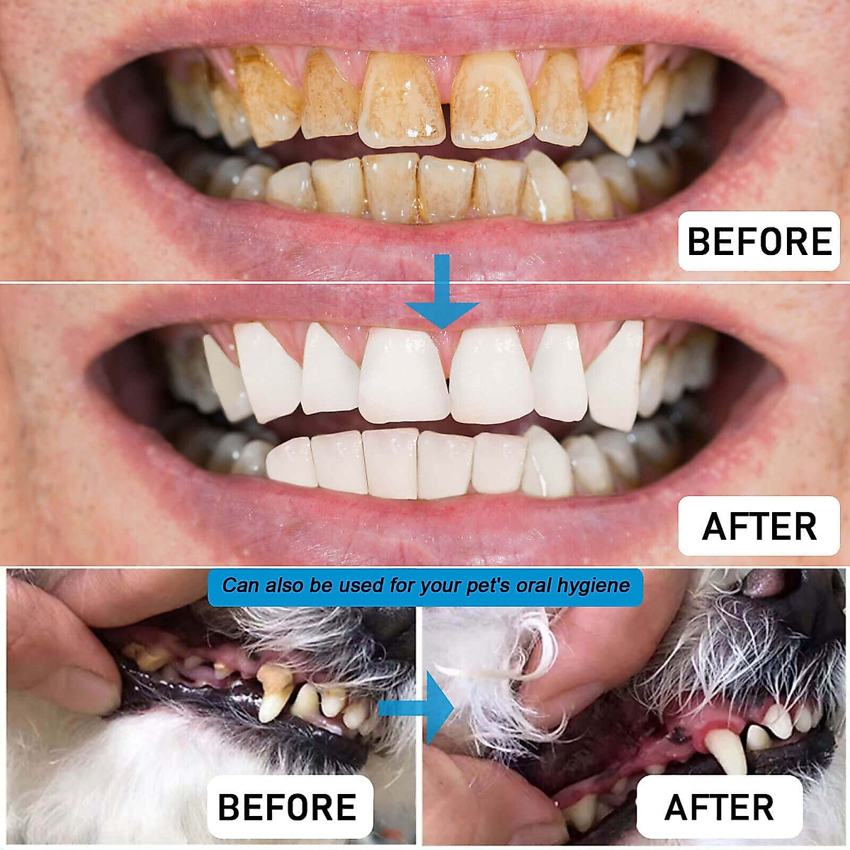 3Pcs Dental Tools, 100% Surgical 304 Stainless Steel Dental Pick, Professional Teeth Cleaning Kit for Home Use, Tartar Plaque Remover for Teeth Dentist Tools, Dental Scaler- with Traveling Case