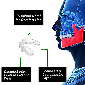 BESPORTBLE 3Pcs Dental Night Protector Dental No More Teeth Grinding Food Grade EVA Supplies for Kids (Transparent)