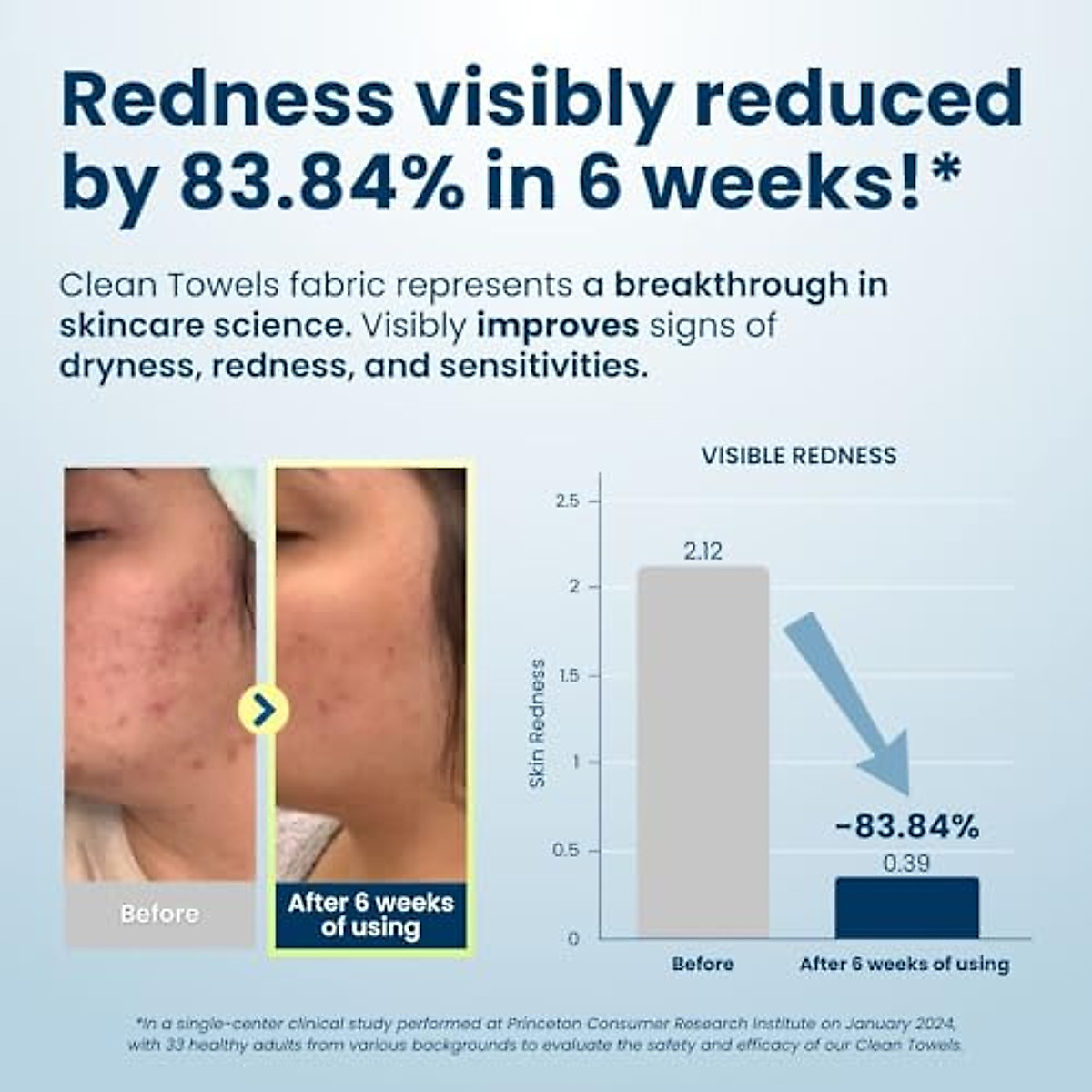 Clean Skin Club Clean Towels, 100% USDA Biobased Dermatologist Approved Face Towel, Disposable Clinically Tested Face Towelette, Facial Washcloth, Makeup Remover Dry Wipes, Ultra Soft, 100 ct, 4 pack