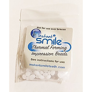 Instant Smile Upper Veneer