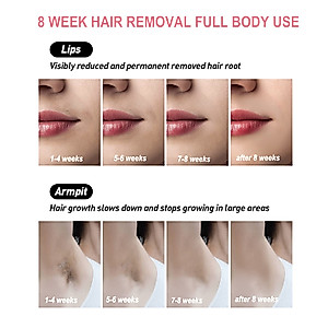 LANGQII IPL Hair Removal Device - Permanent Hair Removal for Women - Bikini Legs Armpit Facial Hair Removal 999,999 Flashes