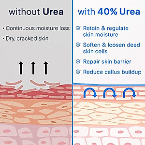 Ebanel Urea Cream 40% plus Salicylic Acid 2%, Foot Cream for Dry Cracked Heels Feet Knees Elbows Hands, Foot Dead Skin Cuticle Callus Remover Toenail Softener, Keratolytic Skin Barrier Repair Cream