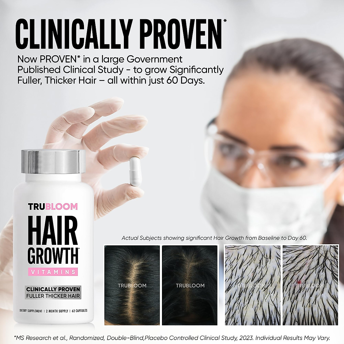 St. Tropica Tru Bloom Hair Growth Vitamins - 2 Month Supply. Clinically Proven for Fuller, Thicker Hair. Natural & Drug-Free. Ultimate Hair Vitamins for Proven Results