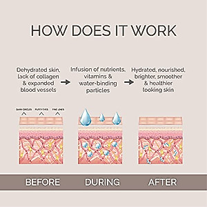 Original Sleek 24k Gold Under Eye Patches (20 pairs) - collagen patches, dark under eye circles treatment, bags under eyes treatment for women,puffy eye mask, under eye mask patches