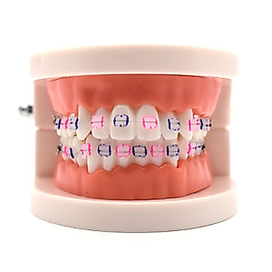 Angzhili 1 Piece Dental Demonstration Orthodontic Model with Metal Wires and Bracket (Ceramic bracket)