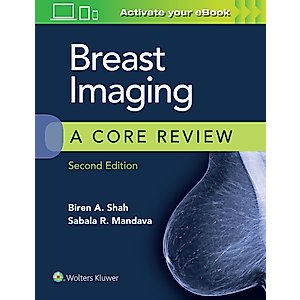 Breast Imaging: A Core Review