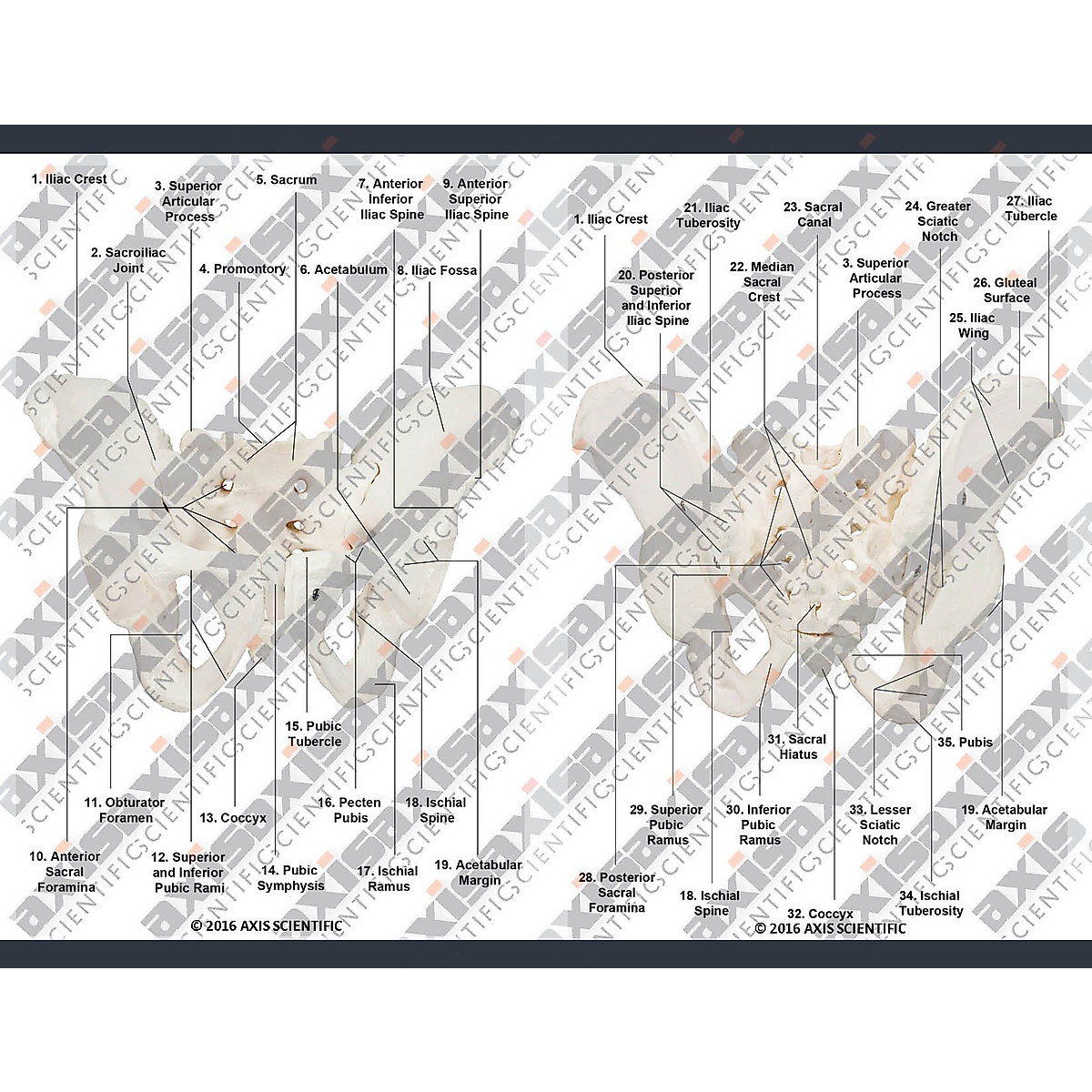 Axis Scientific Male Pelvis Model, Life Size Pelvic Human Anatomy Features Hip, Sacrum, and Coccyx, Includes Detailed Manual