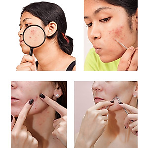 SAVBIN 7-Piece Blackhead/Comedone/Pimple Extraction Kit for Nose Face etc