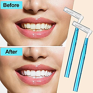 Jutom 100 Pcs Interdental Brush Tooth Floss Brush for Teeth Toothpick with Refill Heads Micro Tight Dental Picks for Teeth Cleaning Disposable Toothbrush Flossing Oral Braces Toothbrush (Blue)