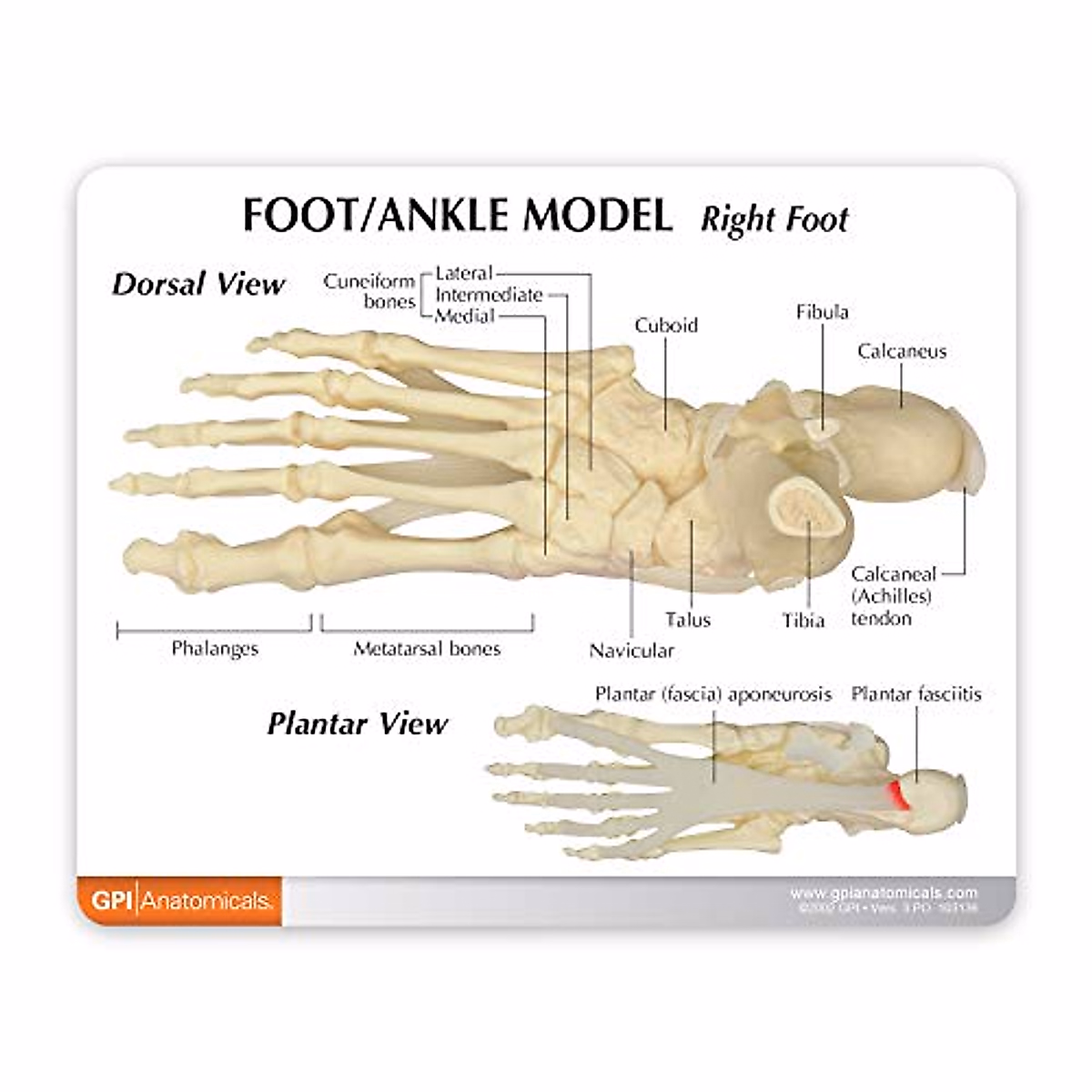 GPI Anatomicals - Foot & Ankle Model | Human Body Anatomy Replica of Foot & Ankle w/Plantar Fasciitis for Doctors Office Educational Tool