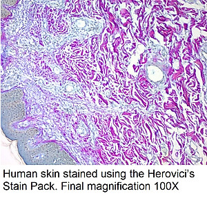 Herovici's Stain Pack, 500ml