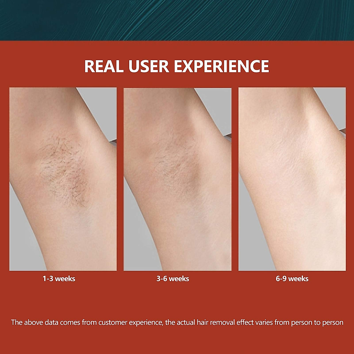 Hair Removal Machine, 808 Semi-Conductor Laser Hair Removal Machine Mini Portable Ice Compress Depilation Instrument(US)