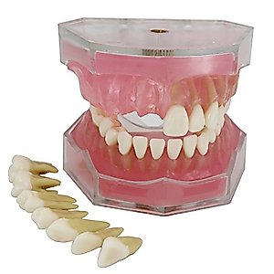 Dental Implant Teeth Model Study Teach Standard Model with Removable Teeth