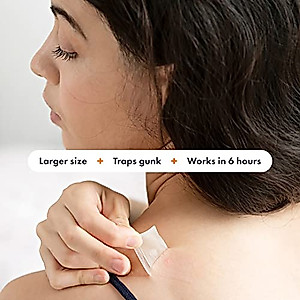 Mighty Patch Variety Pack from Hero Cosmetics - Hydrocolloid Acne Pimple Patches for Covering Zits and Blemishes, Spot Stickers for Face and Skin, Vegan-friendly and Not Tested on Animals (26 Count)