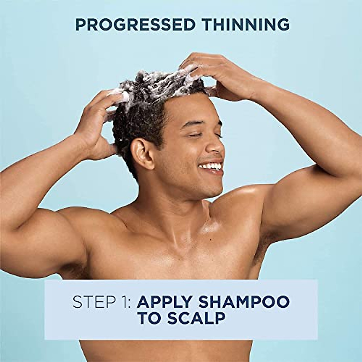 Nioxin Scalp + Hair Thickening System 2 Leave on Treatment, For Natural Hair with Progressed Thinning, 6.8 oz (Packaging May Vary)