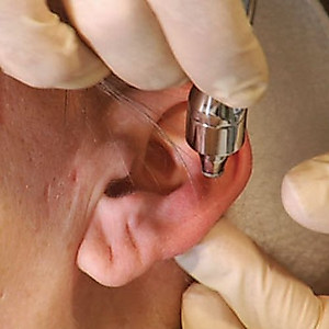 Microdermabrasion: Crystal-Free Techniques DVD - Learn How To Use a Microderm Machine In This Skin Care Training- Learn Cosmetic Procedures For a Complete Skin Rejuvenation Facial Treatment - Won A Telly Award - Best Video (2 Hrs. 7 Mins.)