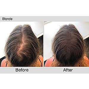 Joan Rivers Great Hair Day Root Touch Up Powder for Thinning Hair - Root Cover Up Hair Powder for Thicker, Fuller Looking Hair - Fill-In Powder and Gray Hair Coverage (Blonde)