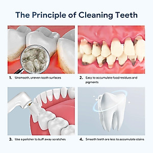 6 Tooth Polisher Replacement Brush Heads，Replacement Heads for Tooth Polisher,Teeth Tartar Remover Accessories,6 Varied Brush Heads Replacement Heads Kit