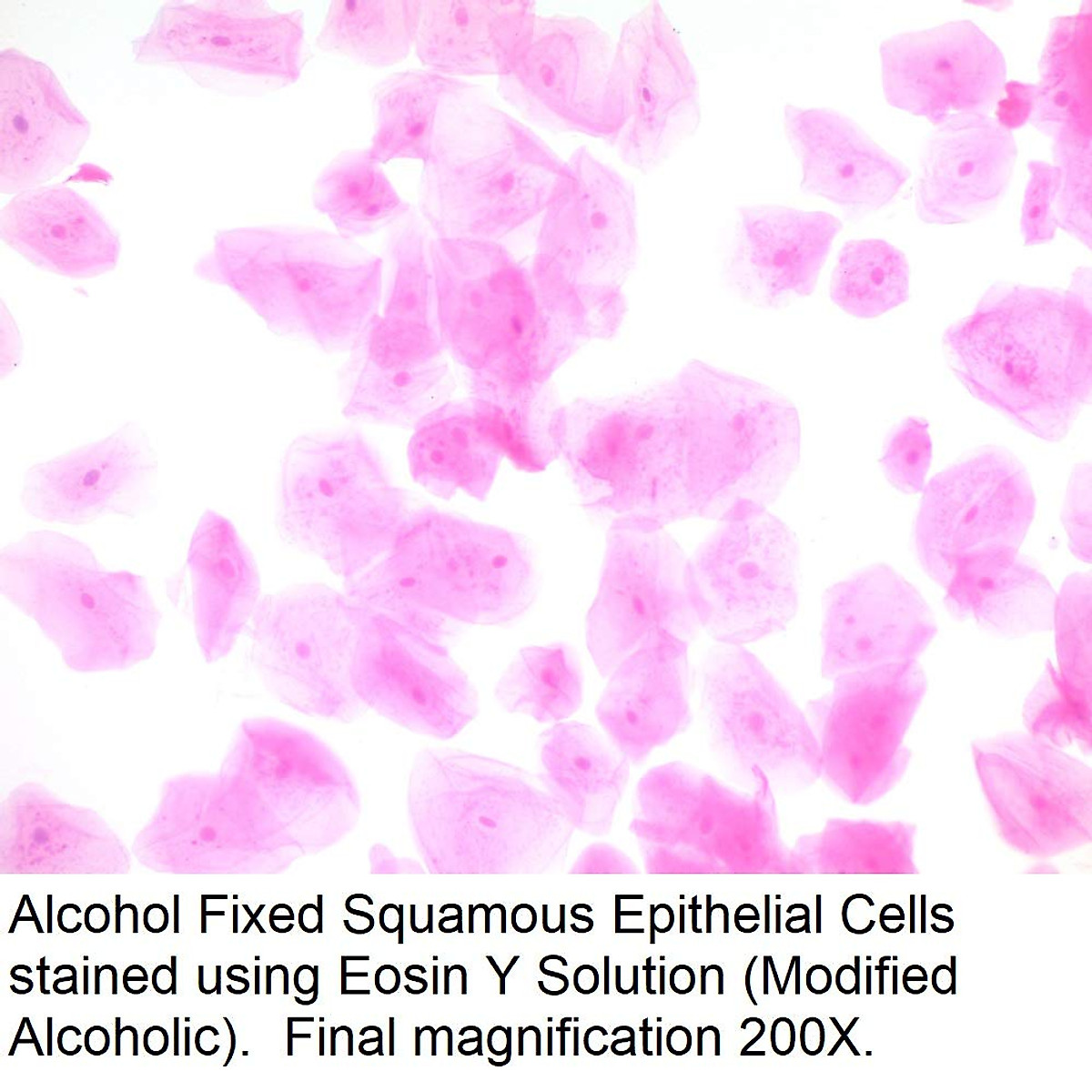 Eosin Y Solution (Modified Alcoholic), 1 Gallon