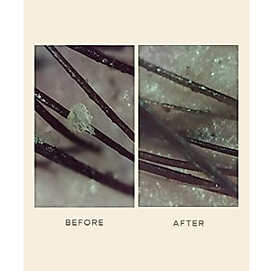 VEGAMOUR GRO Scalp Detoxifying Serum, 2 FL Ounce