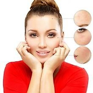 Tend Skin Brightoner Serum Roll on, 2.5 ounce