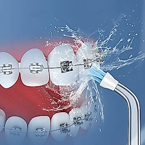 Replacement Tips for Waterpik Water Flosser Classic Jet Tips Waterpik' Replacement Parts and Other Oral Irrigators (AquaFlosser 6 Tips)