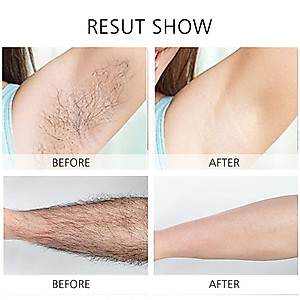 AHUADA Women's Electric Shaver Replacement Heads : 5 Legs Hair Removal Razor Replacement Heads 4D Floating Heads Replacement Blades for Women