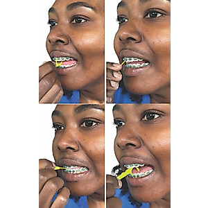 LBailar Braces Toothbrush Rechargeable with 4 Heads Bonus 2