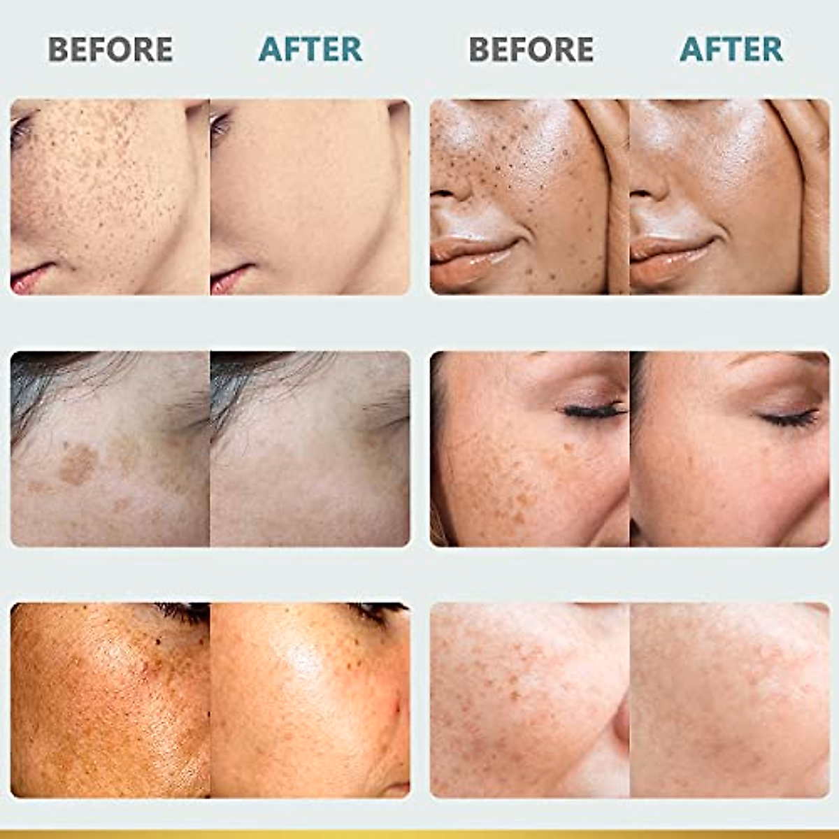 CITYGOO Dark Spot Remover for Face and Body, Dark Spot Corrector Cream, Natural Ingredient,Enriching Skin Care For All Skin Tones - Sun Spot, Melasma, Freckle Remover & Blemish Reducer-1 FL OZ