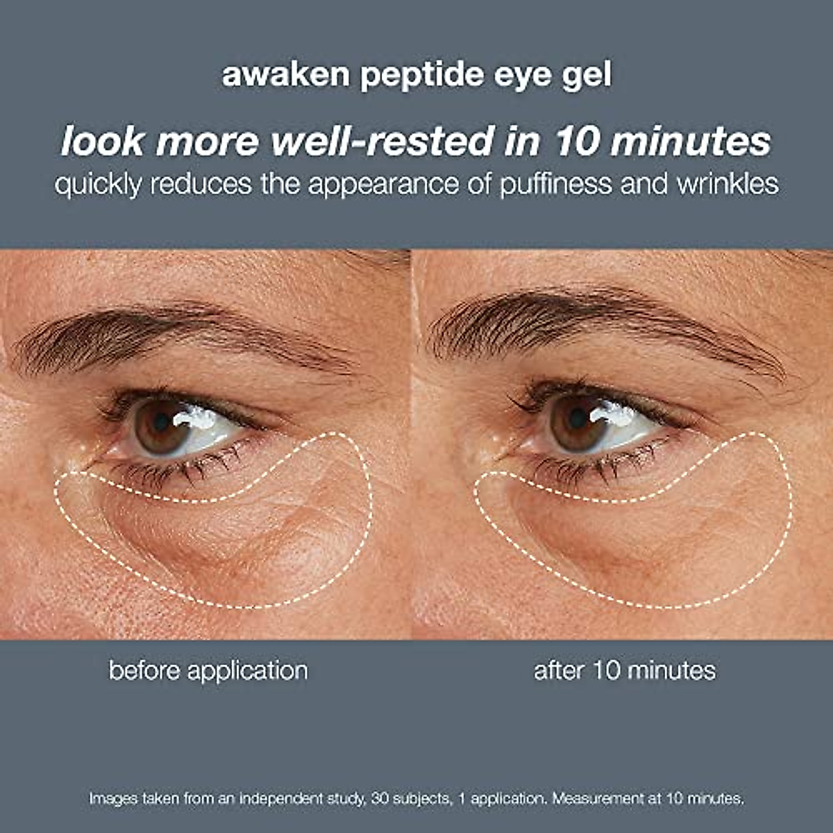 Dermalogica Awaken Peptide Eye Gel - Quickly Reduces The Appearance of Puffiness and Wrinkles