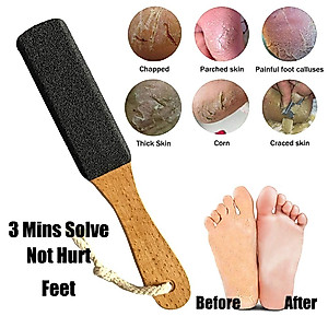 Foot File Callus Remover Foot Scrubber,Professional Pedicure Foot Rasp Removes Cracked Heels,Dead Skin,Corn,Hard Skin,Pumice Stone for Feet Scraper File Brush Tools for Wet and Dry Feet
