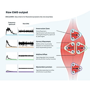 MyoWare 2.0 Muscle Sensor-Compatible with Arduino- All-in-one electromyography (EMG) sensor from Advancer Technologies -Measure muscle activity by detecting its electric potential-Keyed Snap Connector